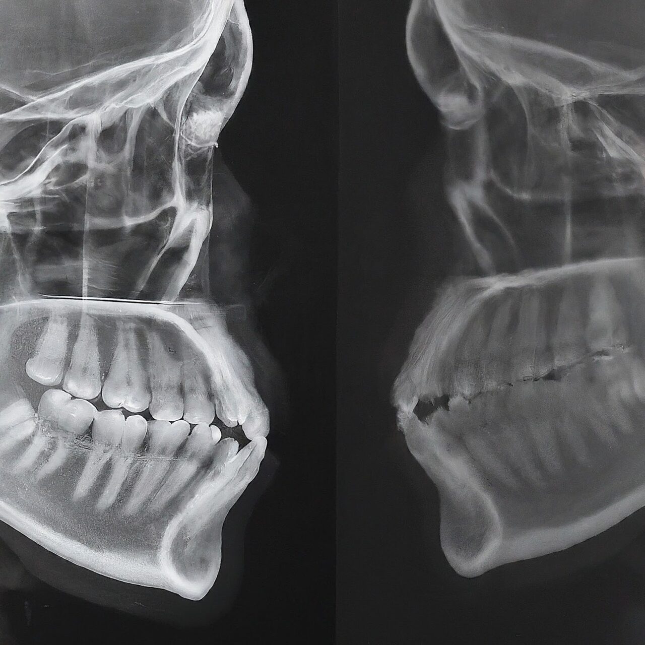- Kingsway Dentist Why CBCT Scans Are Essential for Advanced Root Canal ...